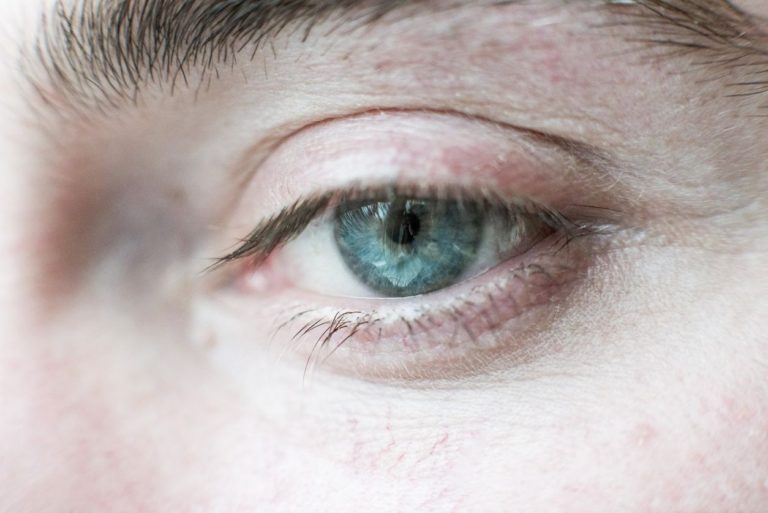 Stress et clignement des yeux : comment calmer ses tics nerveux